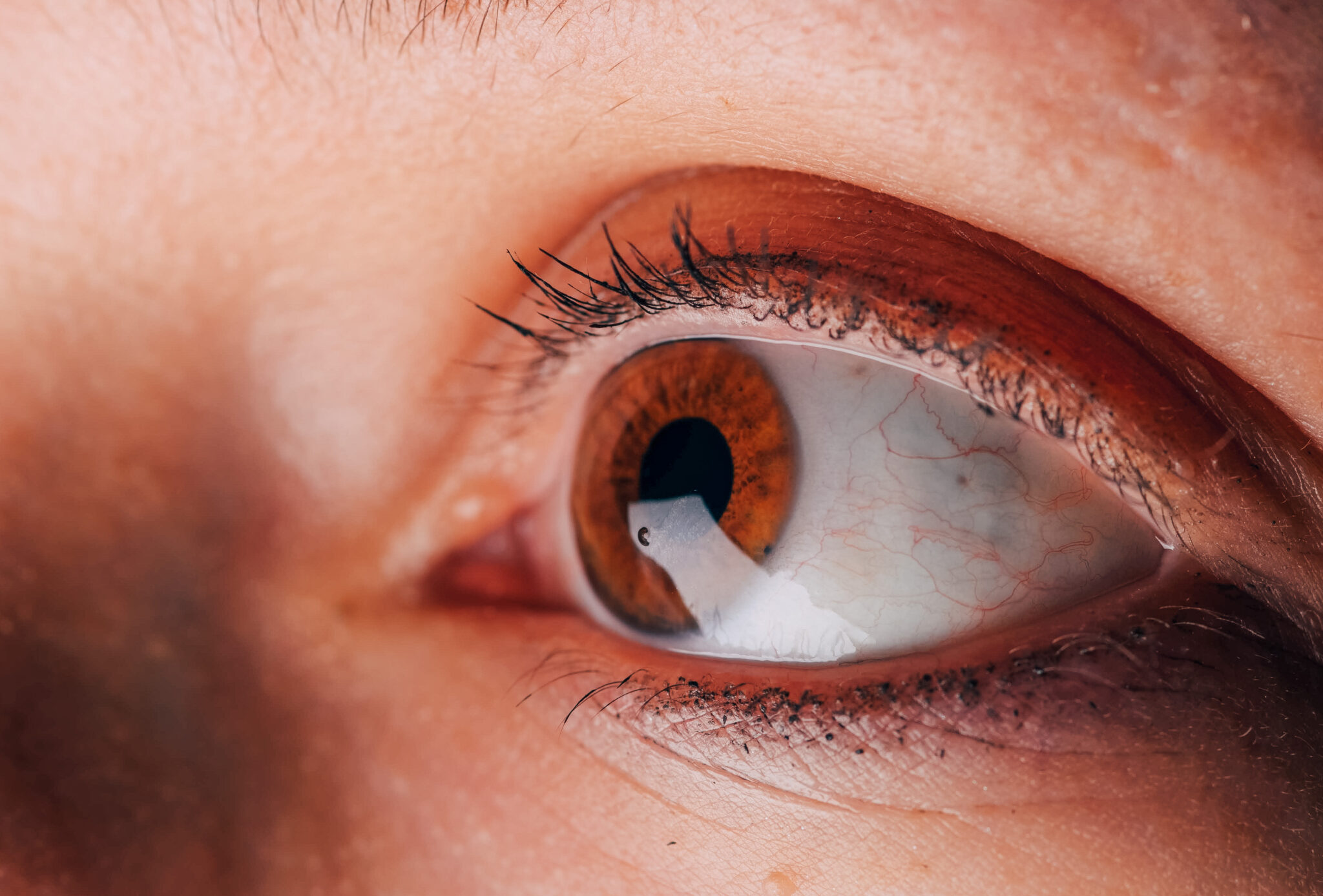 Fadiga ocular: regra 20-20-20 pode ajudar!